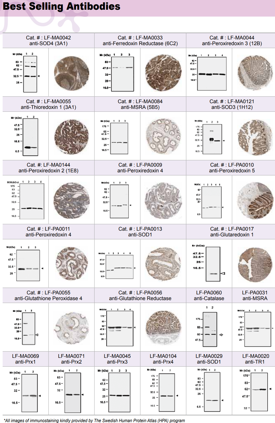 ROS Signaling | Young in Frontier